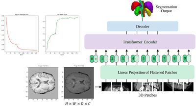 3D Medical image segmentation with transformers tutorial | AI Summer