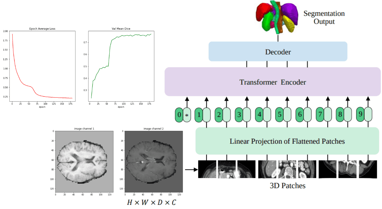 3D Medical image segmentation with transformers tutorial | AI Summer