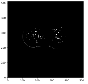 Introduction to medical image processing with Python: CT lung and ...