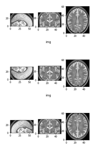 Introduction to 3D medical imaging for machine learning: preprocessing ...