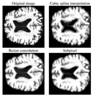Deep learning in MRI beyond segmentation: Medical image reconstruction ...