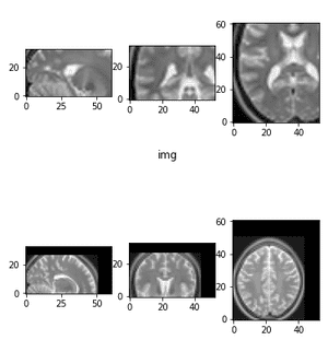 Introduction to 3D medical imaging for machine learning: preprocessing ...