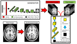 Deep learning in MRI beyond segmentation: Medical image reconstruction ...