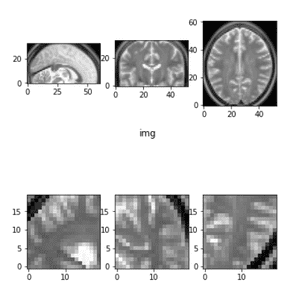 Introduction to 3D medical imaging for machine learning: preprocessing ...