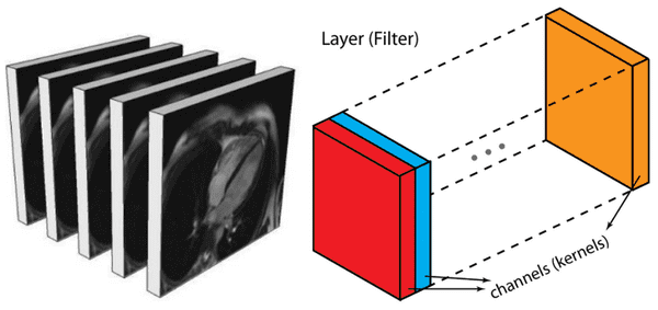 Deep learning in medical imaging - 3D medical image segmentation with ...