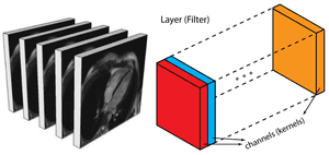 Deep learning in medical imaging - 3D medical image segmentation with ...
