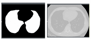 Introduction to medical image processing with Python: CT lung and ...