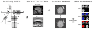 Deep learning in MRI beyond segmentation: Medical image reconstruction ...