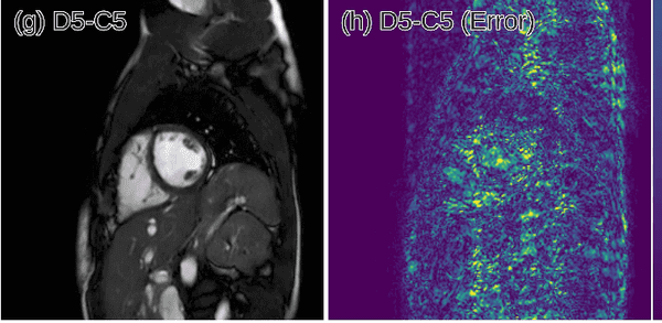 Deep learning in MRI beyond segmentation: Medical image reconstruction ...