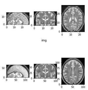 Introduction to 3D medical imaging for machine learning: preprocessing ...