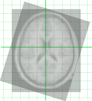 Deep learning in MRI beyond segmentation: Medical image reconstruction ...