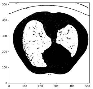 Introduction to medical image processing with Python: CT lung and ...