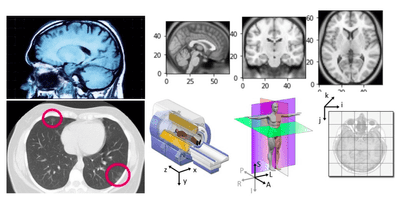 Understanding coordinate systems and DICOM for deep learning medical image analysis | AI Summer
