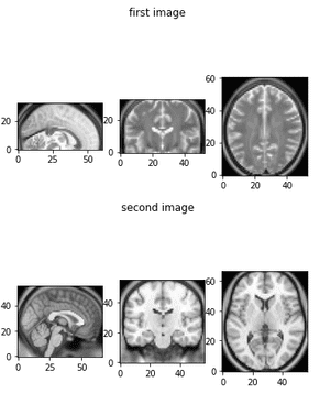 Introduction to 3D medical imaging for machine learning: preprocessing ...