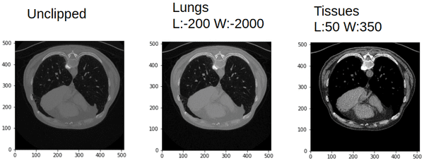 Introduction To Medical Image Processing With Python Ct Lung And