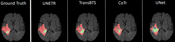 Transformers In Computer Vision Vit Architectures Tips Tricks And Improvements Ai Summer
